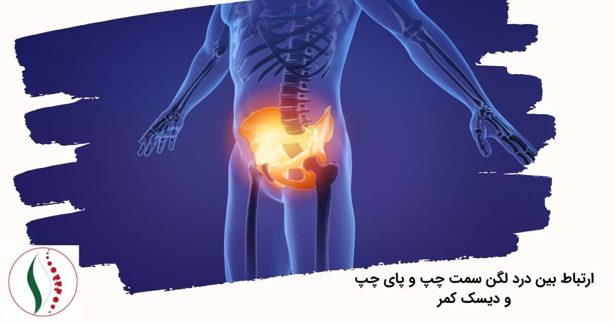 علت درد لگن سمت چپ و پای چپ و راه های درمان |دکتر کاظمی